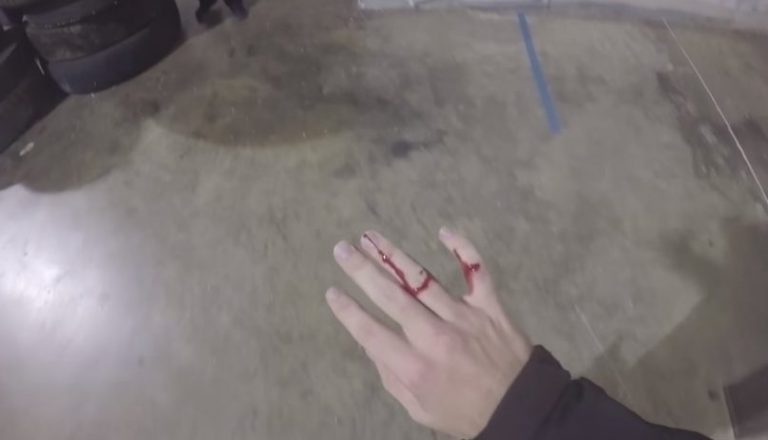 Paintball Injuries - Complete Guide & Tips To Avoid Them